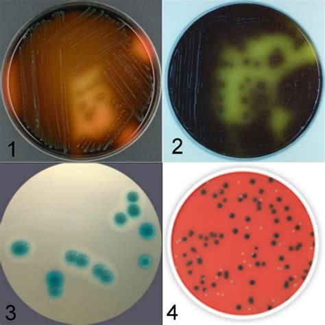 Métodos De Detecção De Listeria Monocytogenes Em Carcaça Bovina