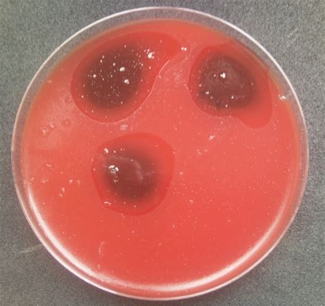 The Inhibition Of Growth Of Enterococcus Faecalis Colonies On The Download Scientific Diagram