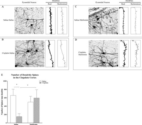 Effect Of Cisplatin And Metformin On Dendritic Spine Density Brains Of Download Scientific