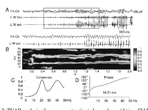 Figure 2 From Eeg Emg Coherence Estimated Using Time Varying