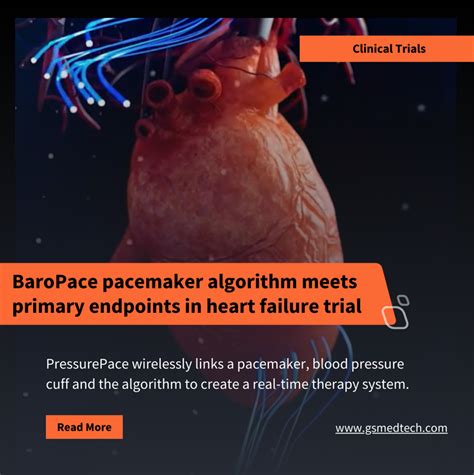 Baropace Pacemaker Algorithm Meets Both Primary Endpoints In Heart