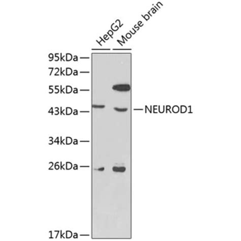 Anti Neurod1 Antibody A13323