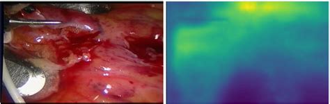 Neural Radiance Fields For Novel View Synthesis In Monocular