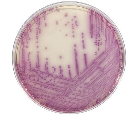 Hardychrom™ Salmonella Chromogenic Medium 15x100mm Pack Of 10 Plates
