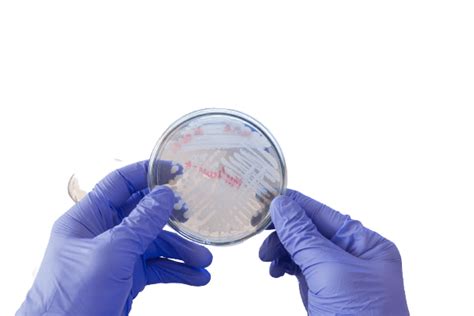 Conventional Pap Smear Test At ₹749 Healthcare Nt Sickcare