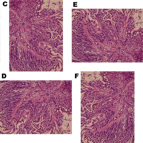 An Example Of Image Augmentation By Rotation And Flipping An Example Download Scientific
