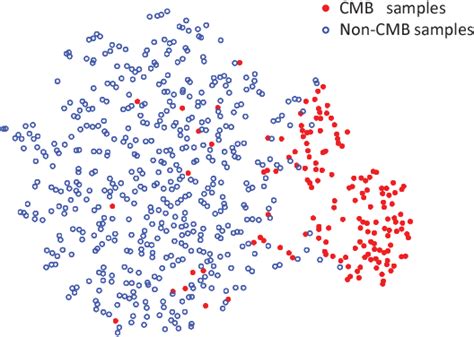 Figure 5 From Automatic Cerebral Microbleeds Detection From Mr Images Via Independent Subspace