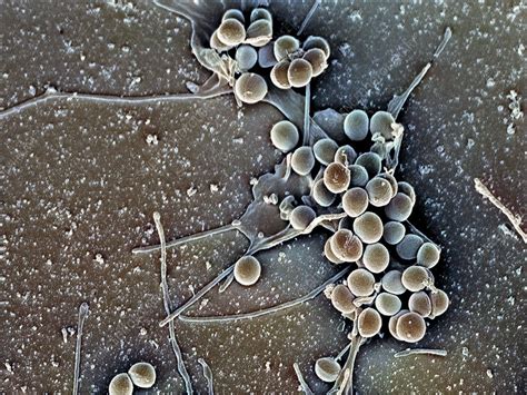 Staphylococcus Aureus Bacteria SEM Stock Image C014 8269 Science Photo Library