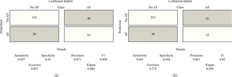 Figure 2 From External Validation Of Safe Score To Predict Atrial Fibrillation Diagnosis After