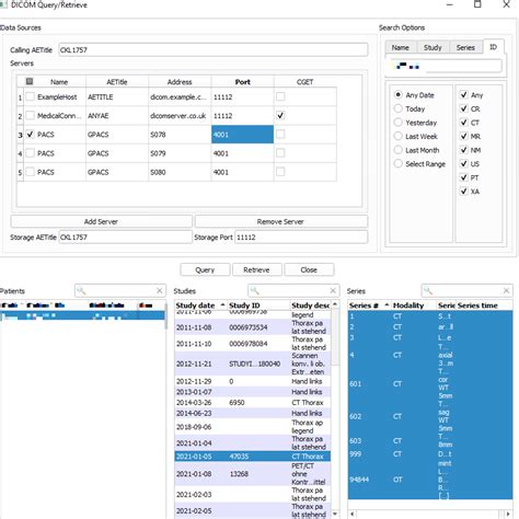 Load Dicom Data Via Networking With Python Script Support 3d