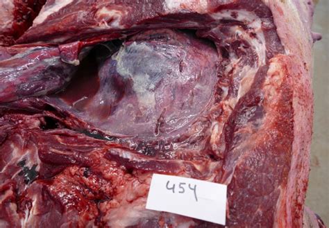 Fibrinous Exudate On Pleura And Pericardium Download Scientific Diagram