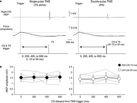 A Example Of Single Pulse TMS Left And Double Pulse TMS Right Download Scientific Diagram