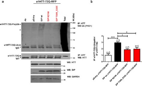 mutations in the n terminal domain of sip decrease the ubiquitination