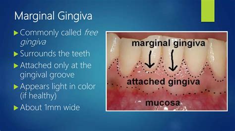 Tooth Structures Periodontium And Caries Classifications Powerpoint