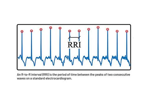 Researchers Develop Deep Learning Model Capable Of Predicting Cardiac Arrhythmia 30 Minutes