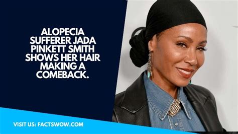 Alopecia Sufferer Jada Pinkett Smith Shows Her Hair Making A Comeback