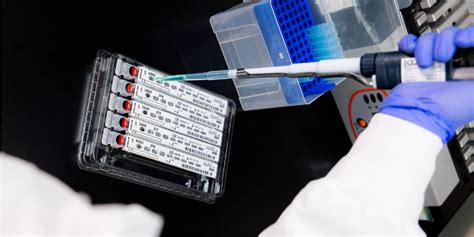 Quality Control Testing Pathogenia