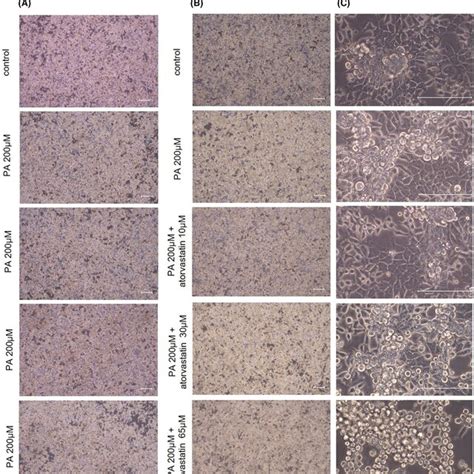 Effects Of 10 30 And 65 μm Atorvastatin On Levels Of Cpla2 And
