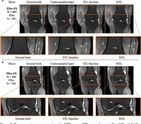 Figure 2 From Multi Task Accelerated Mr Reconstruction Schemes For Jointly Training Multiple