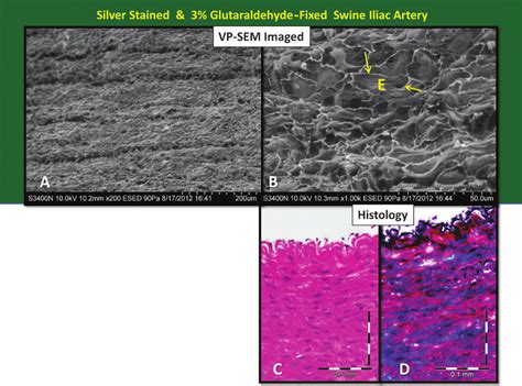 Variable Pressure Scanning Electron Microscopy Vp Sem Imaged Luminal Download Scientific