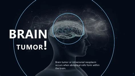 Github Amansaroj9616 Brain Tumur Detection