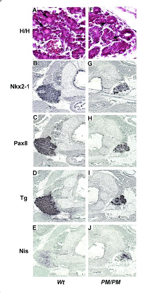Thyroid Differentiation In E18 Pmpm Embryos Transversal Sections Of