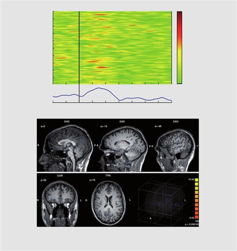 EEG Informed FMRI Analysis In An Auditory Choice Reaction Task A EEG Download Scientific