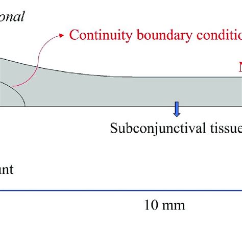 2d Axisymmetric Computational Domain Of The Subconjunctival Drainage Of