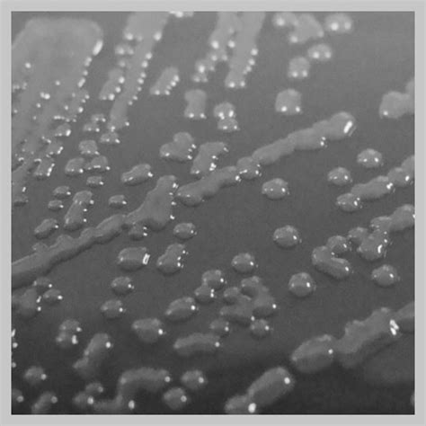 Total Viable Count Sysco Environmental