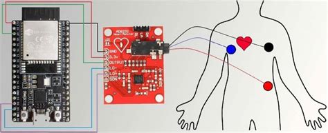 iot ecg monitoring with ad8232 ecg sensor and esp8266