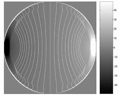 Potential Distribution In Fdm Corner Voxel Formulation Of The