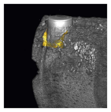 Three Dimensional Micro Ct Reconstructed Images A C E Block Download Scientific Diagram