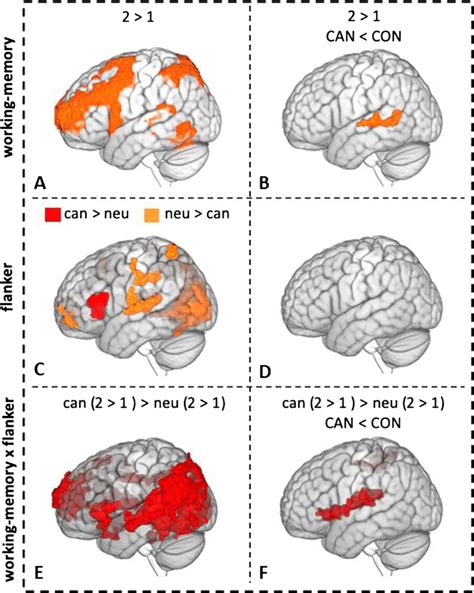 Fmri Results A 2 1 Working Memoryrelated Brain Activity Across