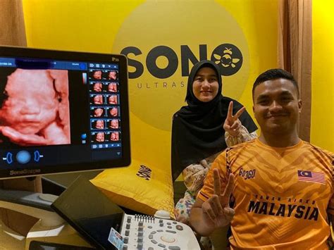 4d Scan Malaysia As Low As Rm58 Sonobee Ultrasound 4d Scan Center In Malaysia