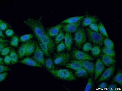 Rnaseh1 Antibody 15606 1 Ap Proteintech