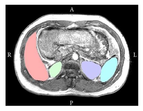 manual segmentation of abdominal organs a and 3d model of abdominal