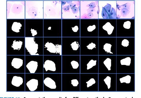 Figure 17 From Segmentation Of Cervical Cell Images Based On Generative Adversarial Networks