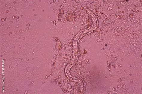 View In Microscopic Strongyloides Stercoralis Or Threadworm In Human