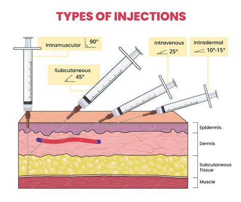 Premium Vector Illustration Of Injection Types Infographic