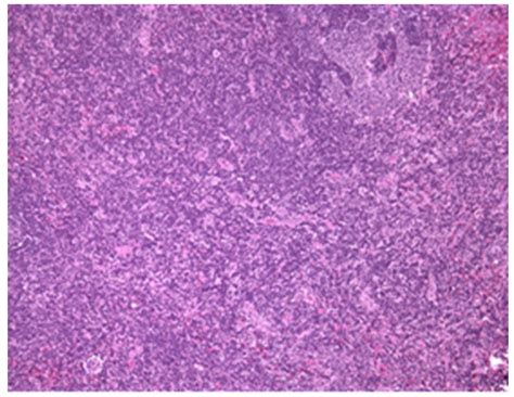 Figure A Shows Low Power View Of Expanded Paracortex Download Scientific Diagram