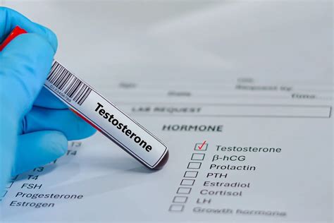 Guide To Psa Free Levels Levels