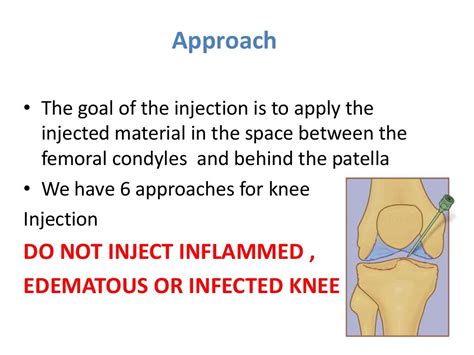 Intra Articular Injection By Dr Ahmed Shedeed