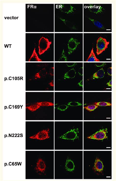 Subcellular Localization Of Wild Type Wt And Mutant Download