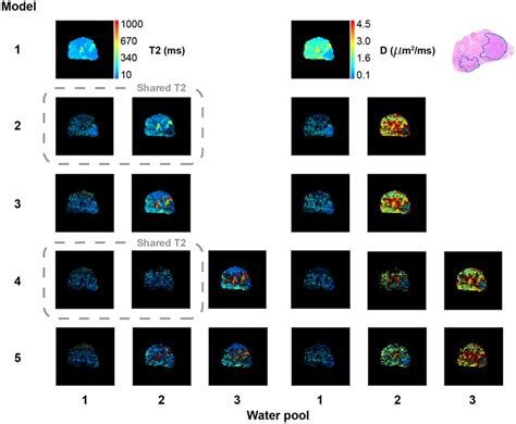Patient 3 Voxelwise Water Pool T2 And D Predictions From Five Download Scientific Diagram