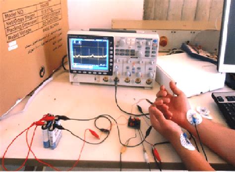Acquisition Du Signal Ecg Sur Loscilloscope Download Scientific Diagram
