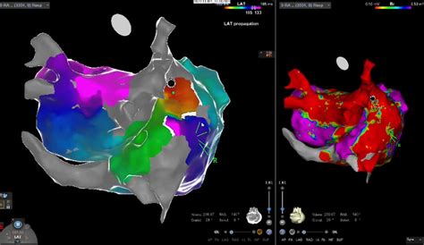 Scott Pass On Linkedin Epeeps