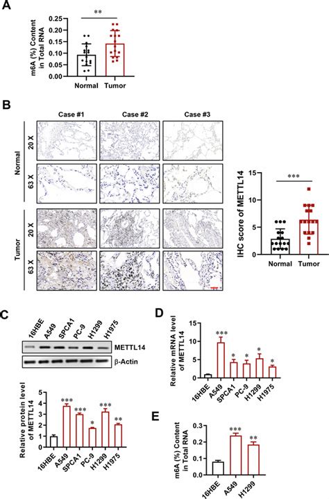 Mettl14 Mediated M6a Mrna Modification Of G6pd Promotes Lung Adenocarcinoma Bohrium