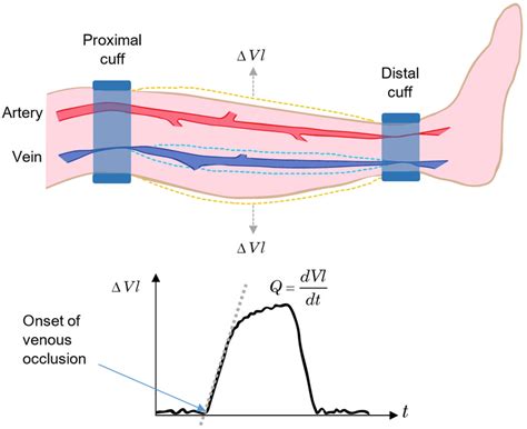 Photoplethysmography Also Known As Ppg Is A Simple And Inexpensive