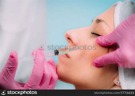 Dermal Filler Injections Beautiful Woman Receives Hyaluronan Dermal