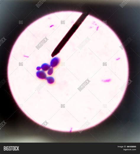 Yeast Cells Under Microscope